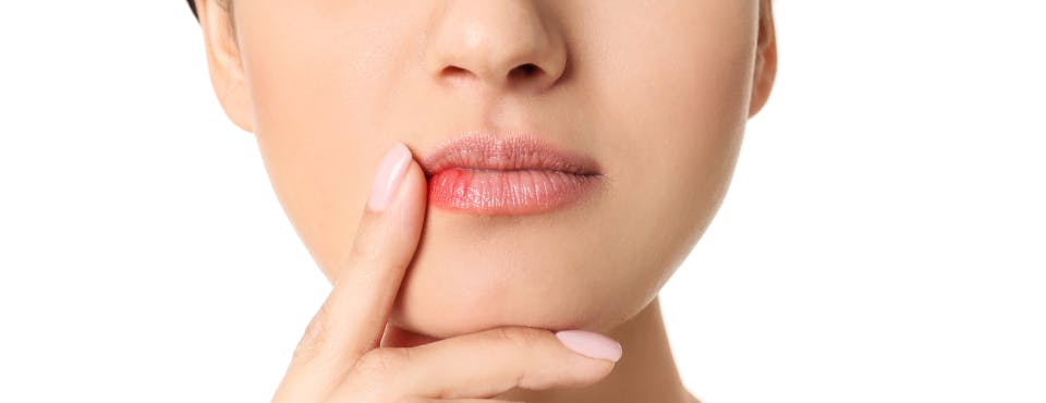 What Causes Allergy On Lips | Lipstutorial.org